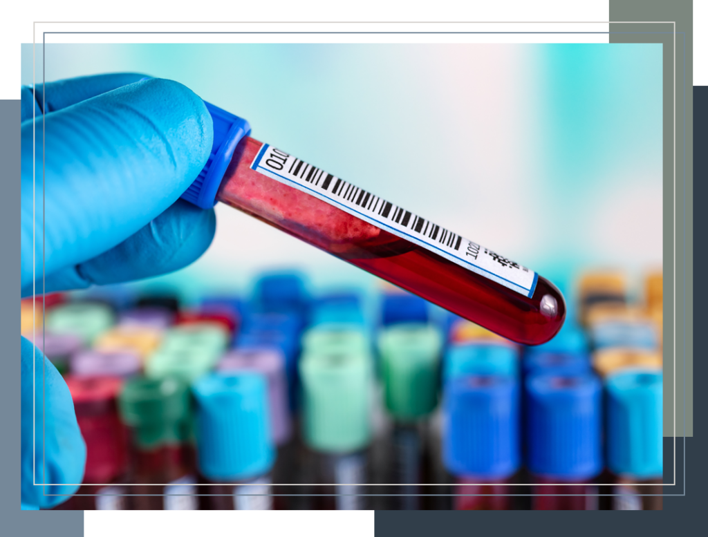 Platelet Rich Plasma Prp Therapy Surprise Az Benehealth